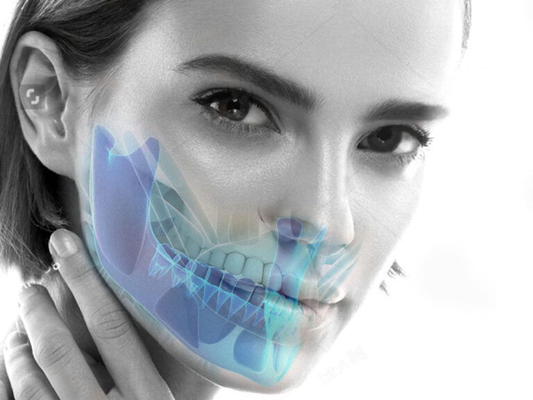 Elevación del seno maxilar en Clínicas Innovación Dental